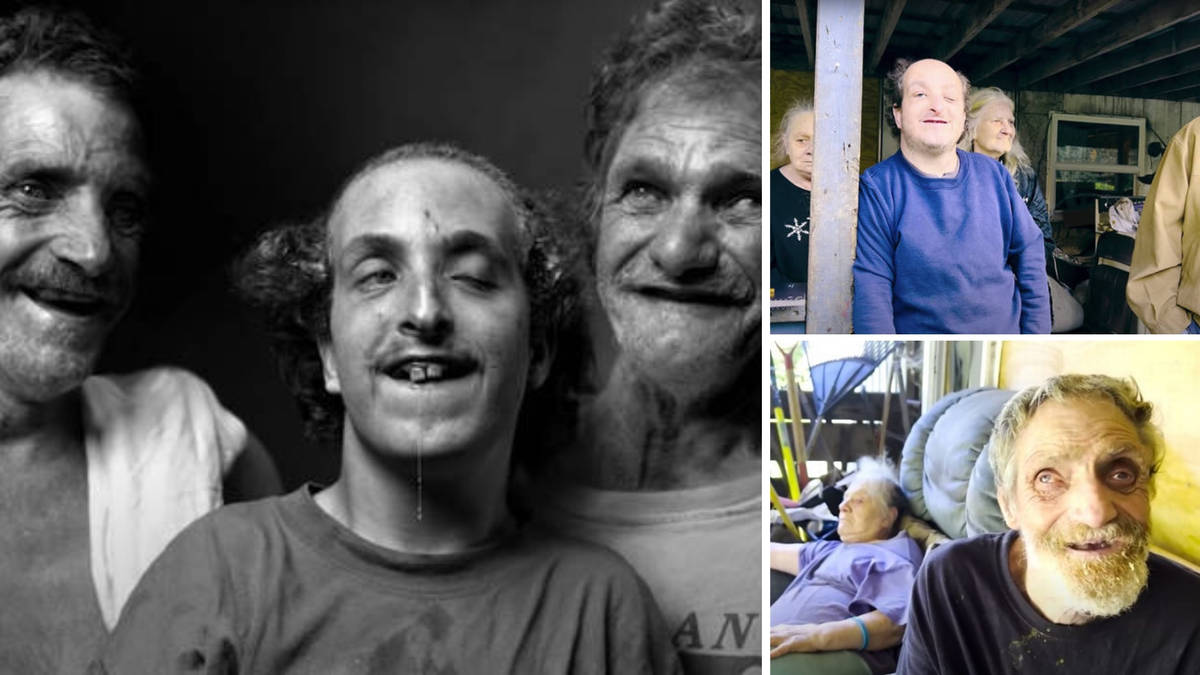 'America's most inbred family' began 'over a century ago with identical ...