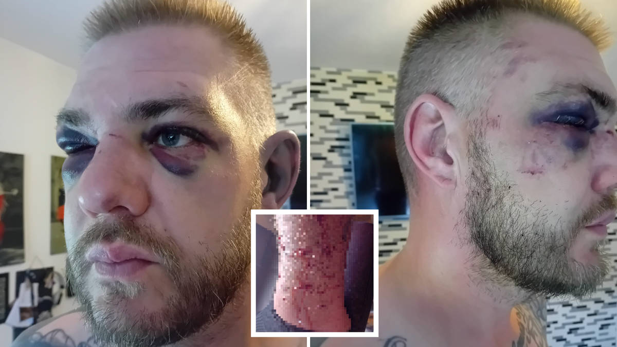 'I was no match for an XL Bully': Man 'lucky to be alive' after being ...