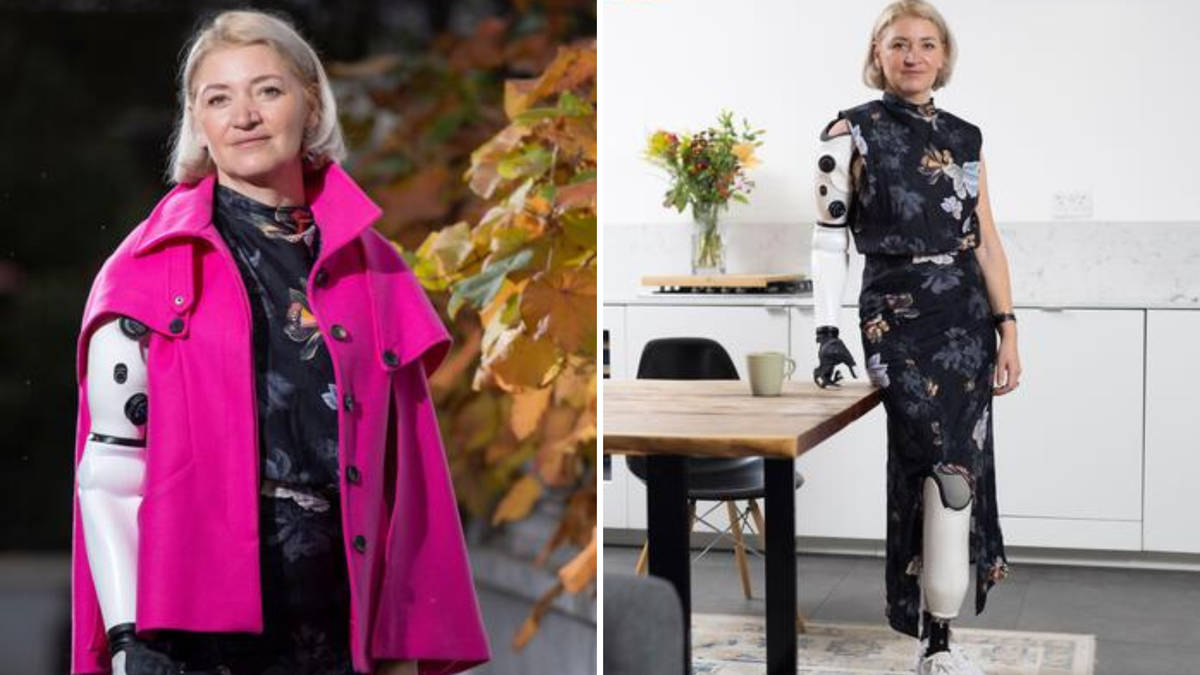 Woman who lost arm and leg after being run over by two Tube trains pays ...