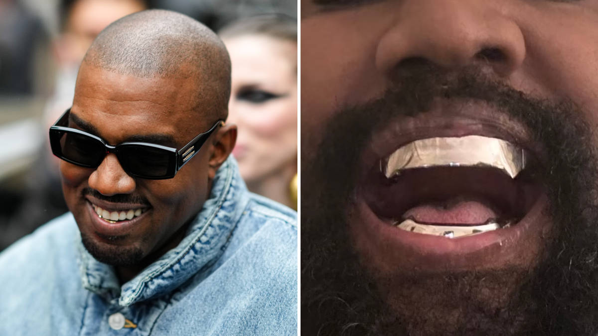 Kanye West spends $850,000 on permanent titanium teeth in drastic ...