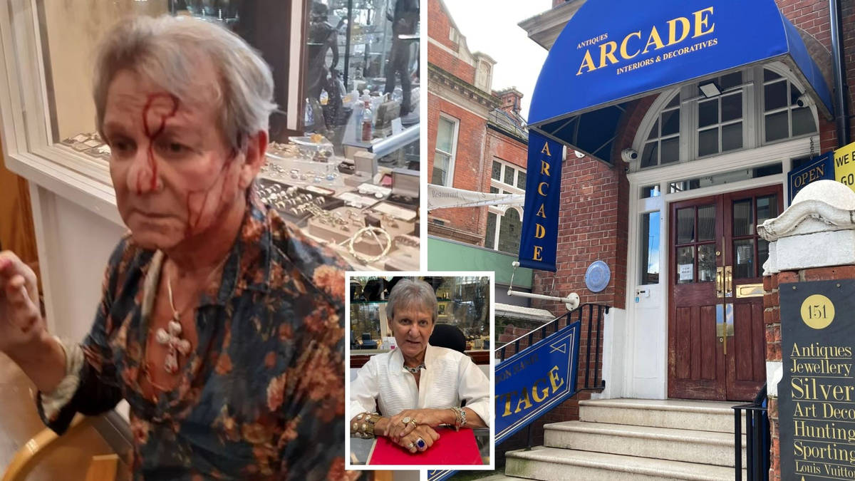 Celebrity antiques dealer shares update after he was 'smashed to bits ...