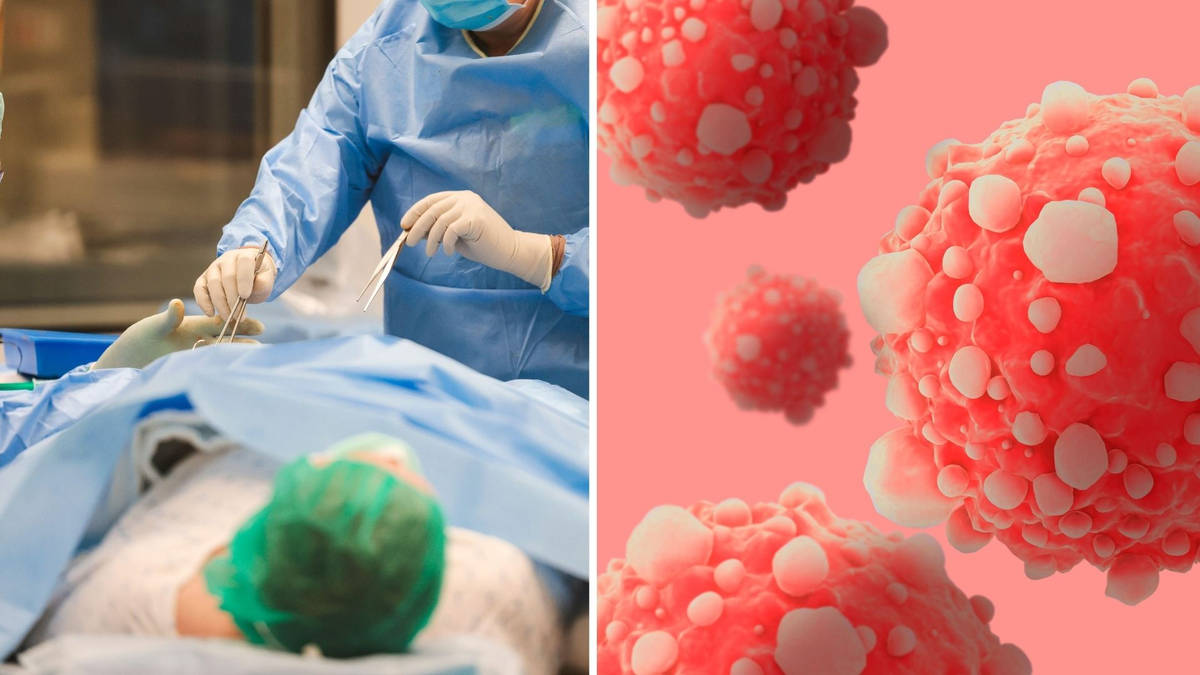 Surgeon 'catches' cancer after operating on patient in first-of-its ...