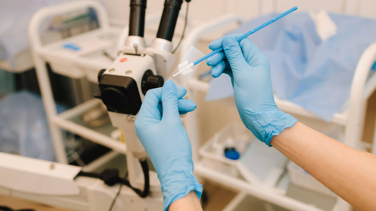 NHS to offer at-home cervical cancer screening test kits that 'could ...