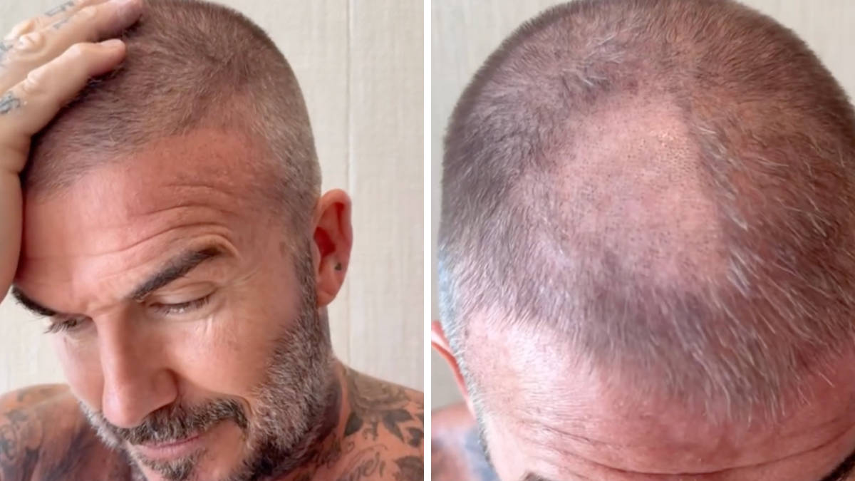 Time for a hat-trick? David Beckham left with bald patch after DIY ...