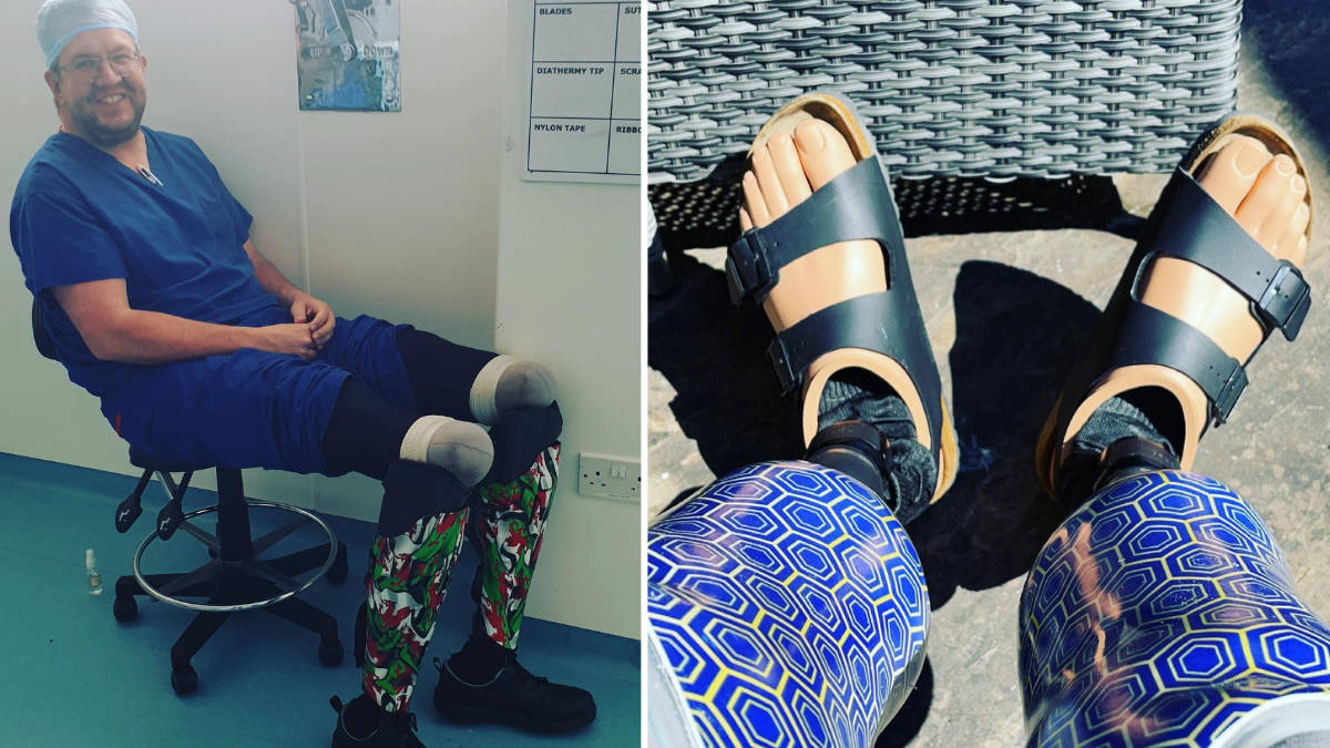 'Britain's bravest surgeon' who lost legs to sepsis accused of fraud ...