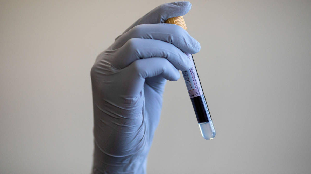 'Game-changing' NHS prostate cancer screening trial begins | LBC