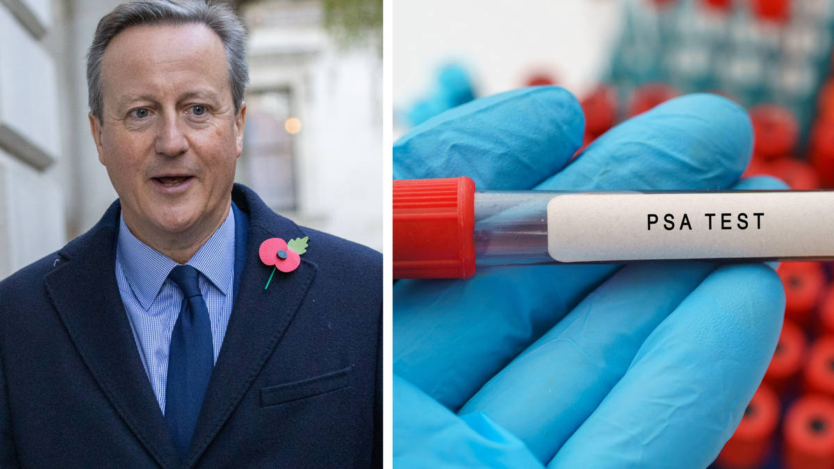 Prostate cancer screenings rationed as David Cameron slams health ...